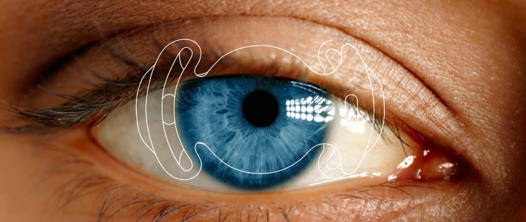 NEW AUTOFOCUS INTRAOCULAR LENS ALLOWS FREEDOM FROM GLASSES AFTER ...