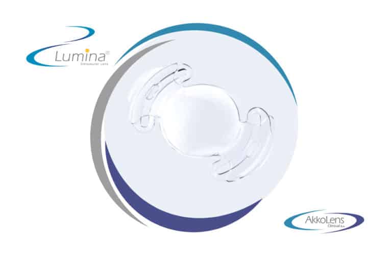 NEW AUTOFOCUS INTRAOCULAR LENS ALLOWS FREEDOM FROM GLASSES AFTER ...